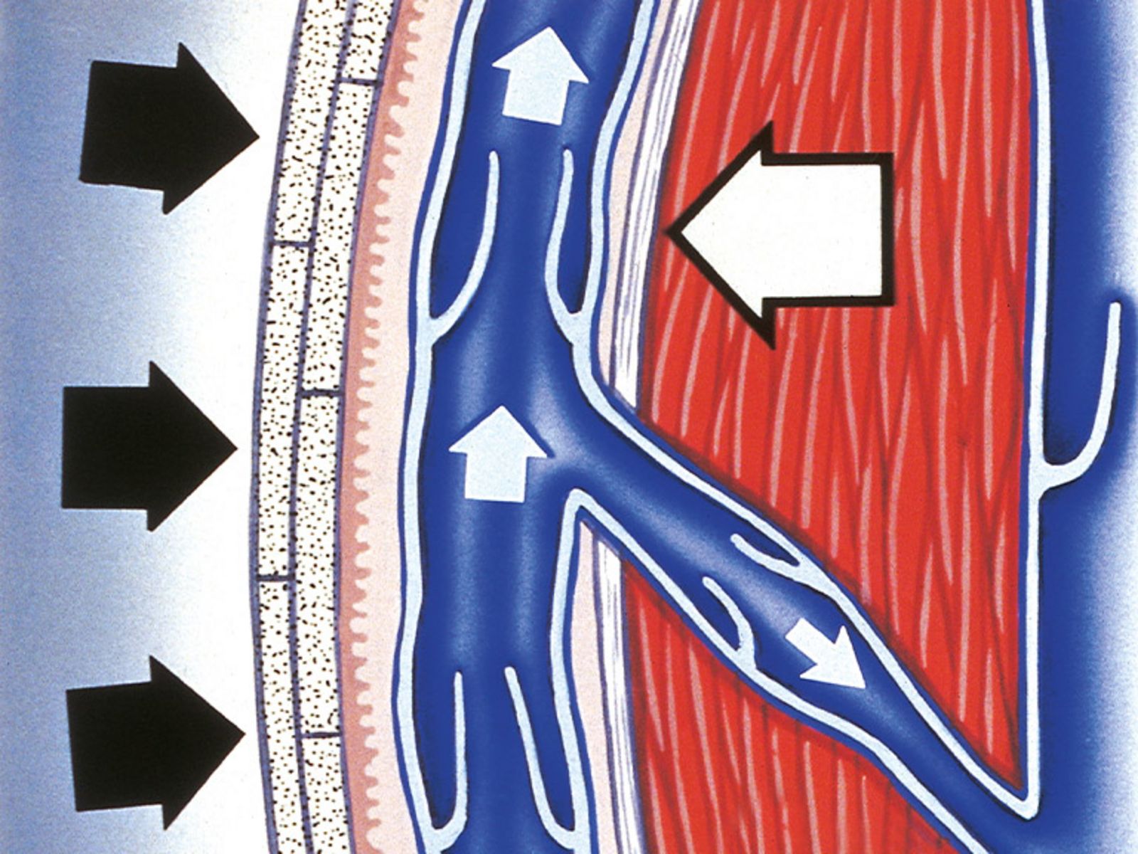 Was ist Kompressionstherapie